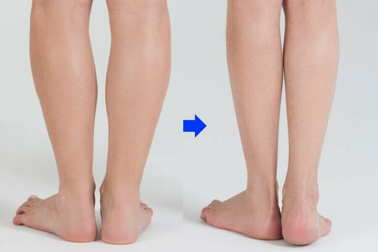 Bắp chân bao nhiêu cm là đẹp đối với phụ nữ và nam giới?